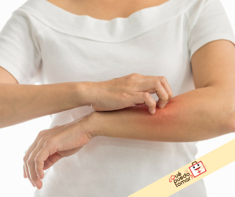 Dermatitis en las manos. Conoce los productos que la empeoran | ¿Qué ...